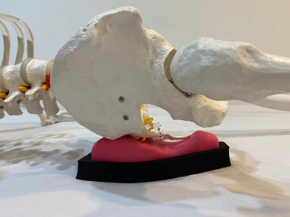 The use of the Sacro Wedgy - The use of the Sacro Wedgy